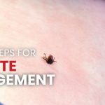 4 Steps to Control Bleeding - The First Aid Kits Australia Newsroom